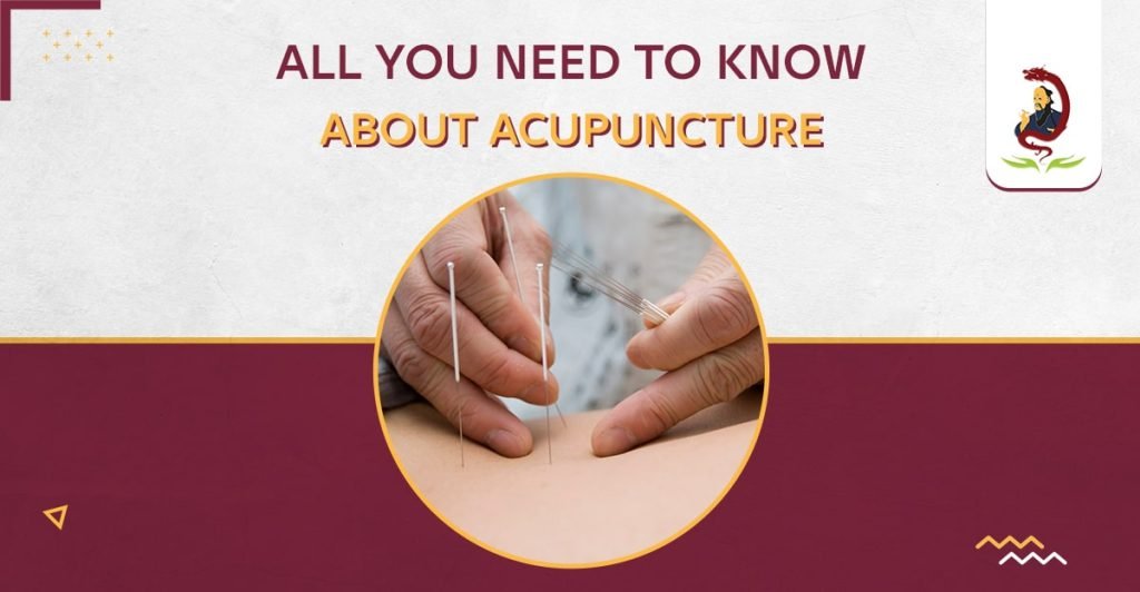 All you need to know about Chinese acupuncture and the basics of ...